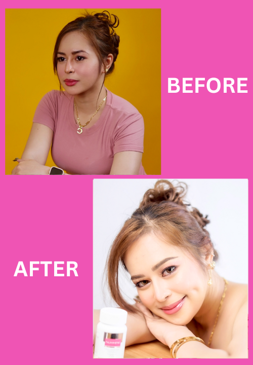 Nuwhite S-Acetyl Glutathione 1 Bottle